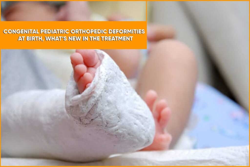 Congenital Paediatric Orthopaedic Deformities at birth, What’s new in ...