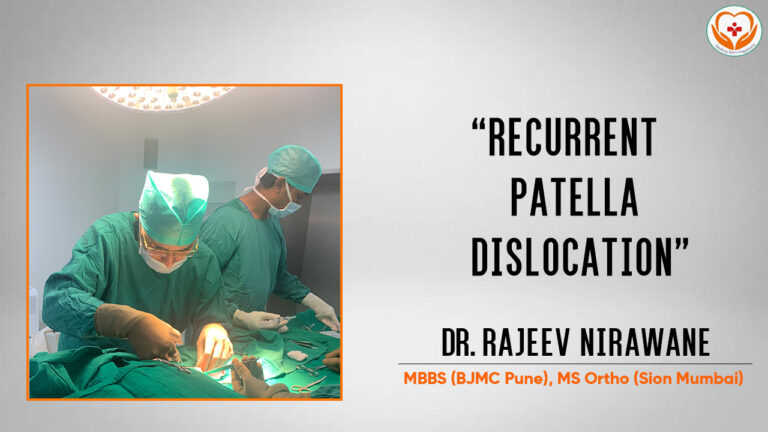 Recurrent Patella Dislocation - Dr Rajeev Nirawane