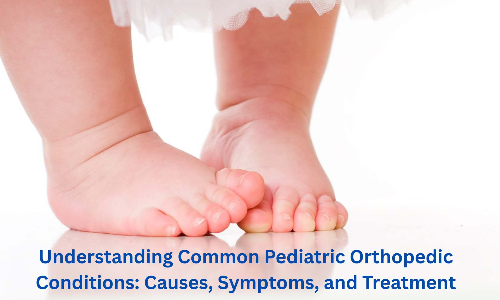 Understanding Clubfoot (Congenital Talipes Equinovarus): Causes ...